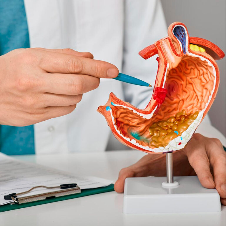 Tratamiento Cáncer Incipiente Tracto Digestivo | Dr. Sandoval